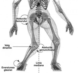 Leziuni ale ligamentelor incrucisate anterioare (LIA) - Dr. Mihai Râșcu